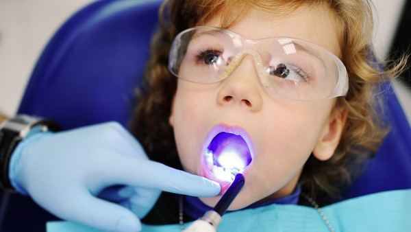Composite vs Amalgam Fillings for Your Children: Your Guide